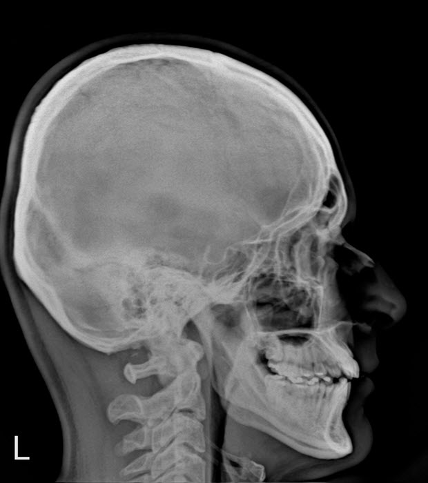 X-ray Systems - Product - ROUUMTECH